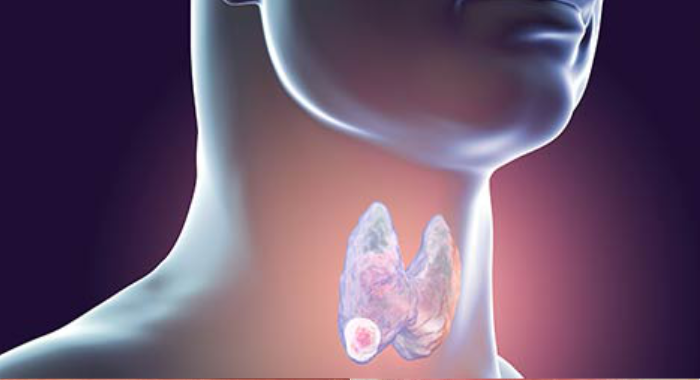 Symptoms of throat cancer you should knowNirbhayam.com